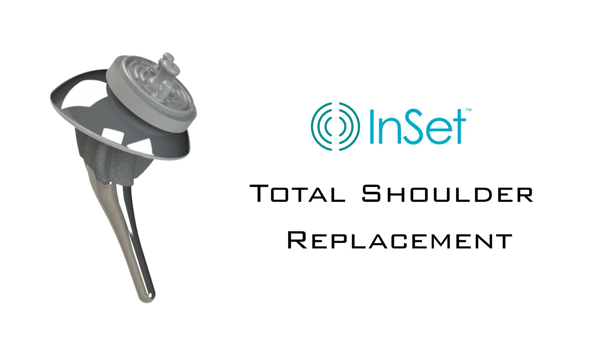 Common Types of Shoulder Surgery - Veronica Diaz, MD